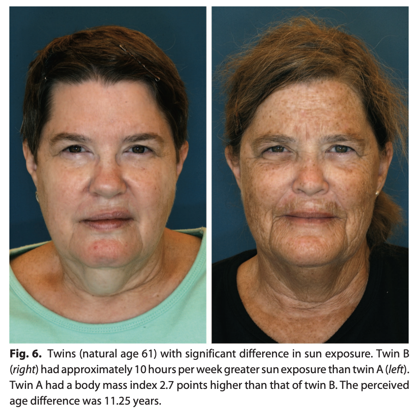 Identical Twins Study 01 | PuPe_So_Sweet